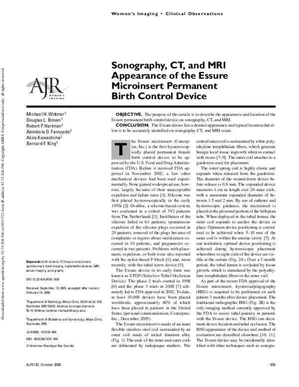 (PDF) Sonography, CT, and MRI Appearance of the Essure Microinsert ...