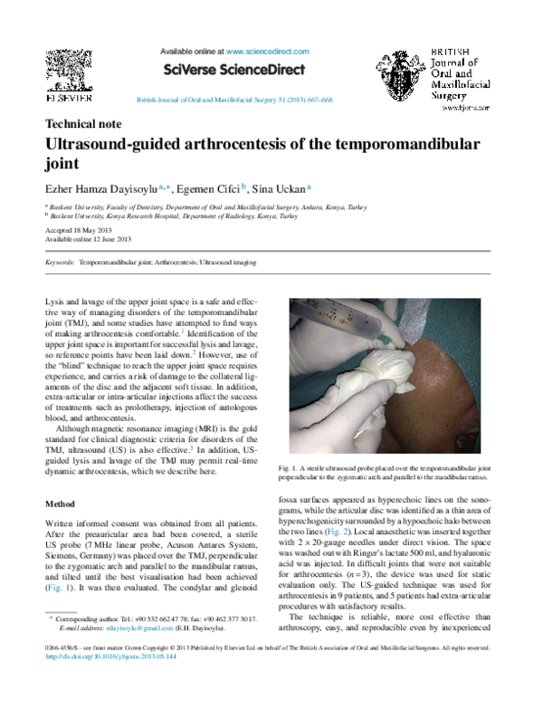 (PDF) Ultrasound-guided arthrocentesis of the temporomandibular joint ...