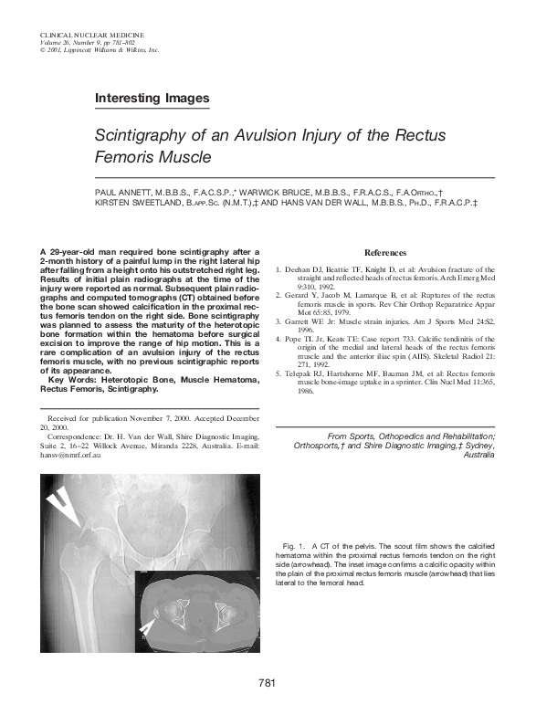 (PDF) Scintigraphy of an Avulsion Injury of the Rectus Femoris Muscle ...