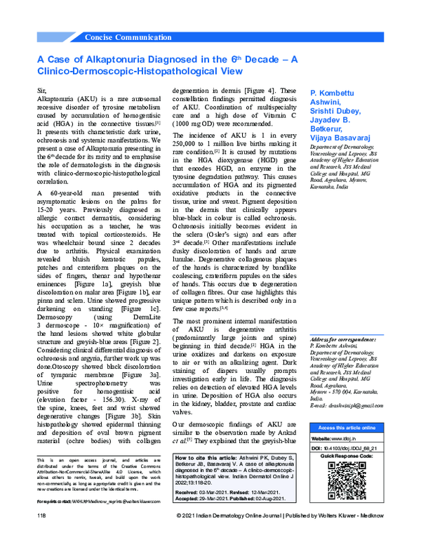 (PDF) A case of alkaptonuria diagnosed in the 6th decade – A clinico ...