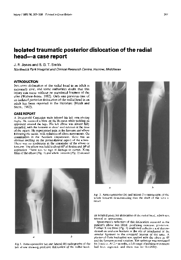 (PDF) Isolated traumatic posterior dislocation of the radial head—a ...