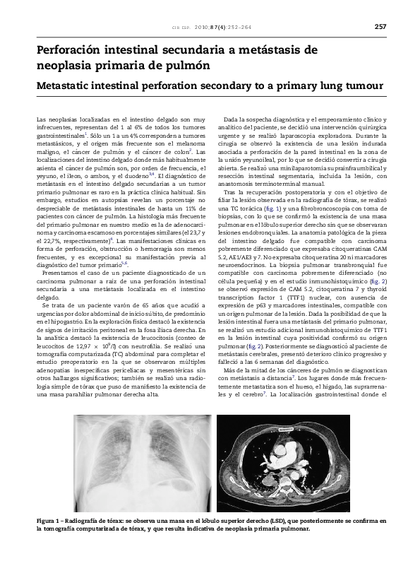 (PDF) Perforación intestinal secundaria a metástasis de neoplasia ...