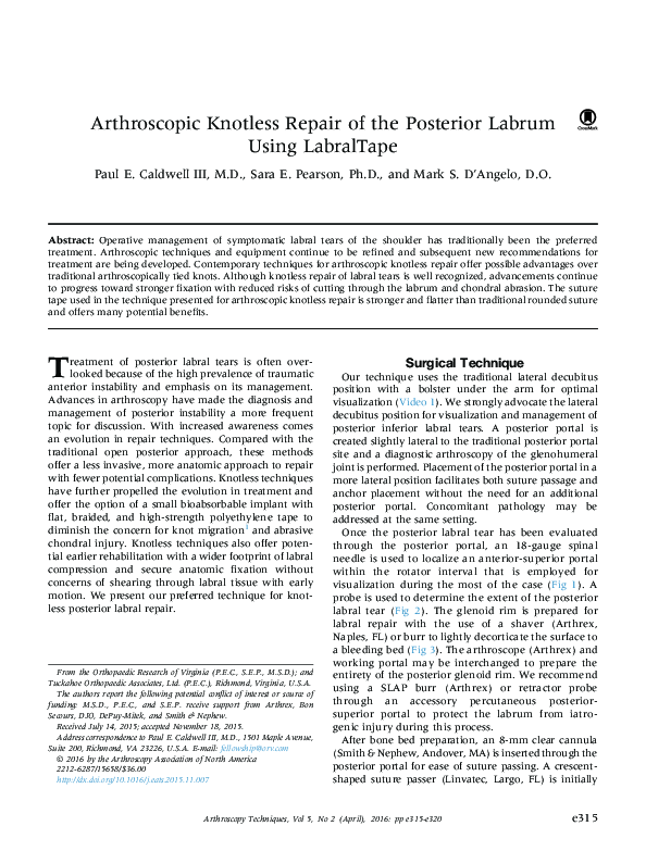 Pdf Arthroscopic Knotless Repair Of The Posterior Labrum Using