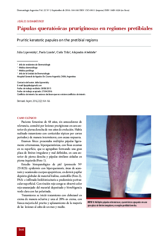(PDF) Pápulas queratósicas pruriginosas en regiones pretibiales