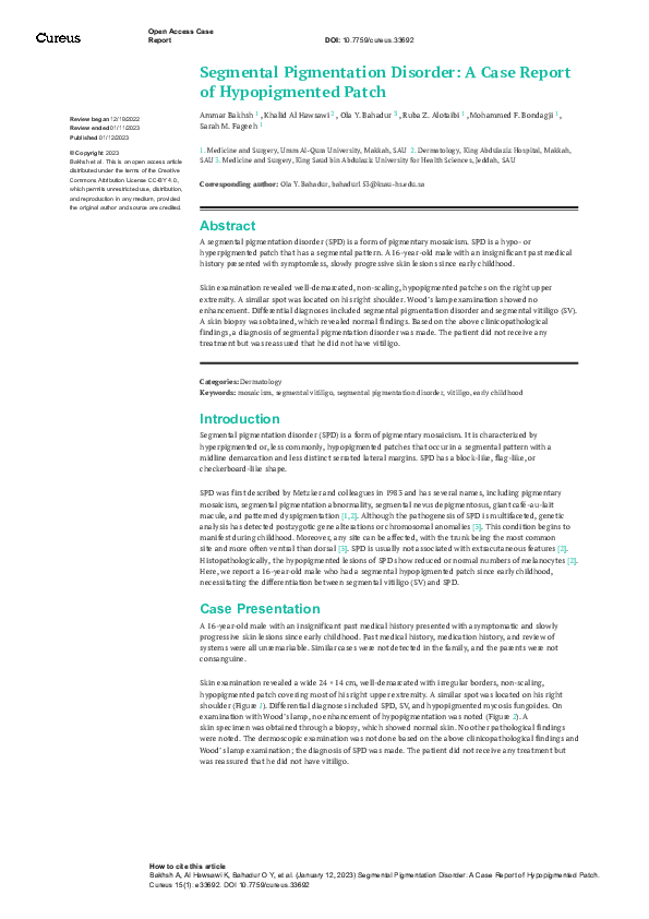 (PDF) Segmental Pigmentation Disorder: A Case Report of Hypopigmented ...