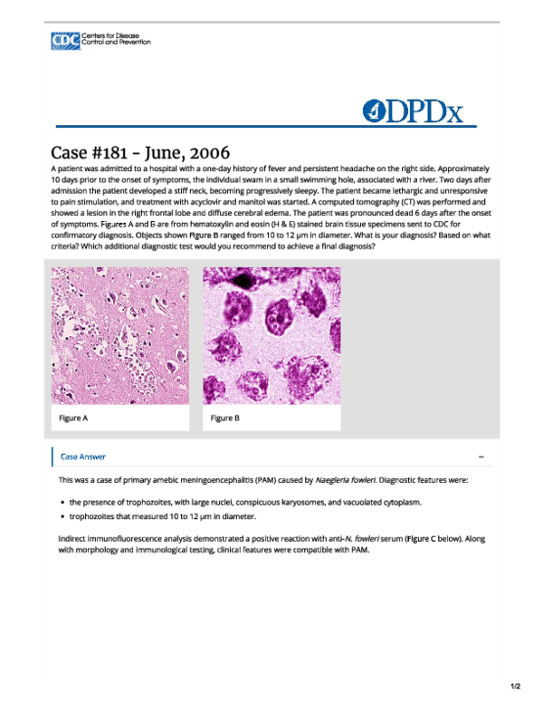 (PDF) Nigleria fowleri case | Marwa Omar - Academia.edu