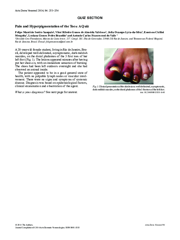 (PDF) Pain and Hyperpigmentation of the Toes: A Quiz