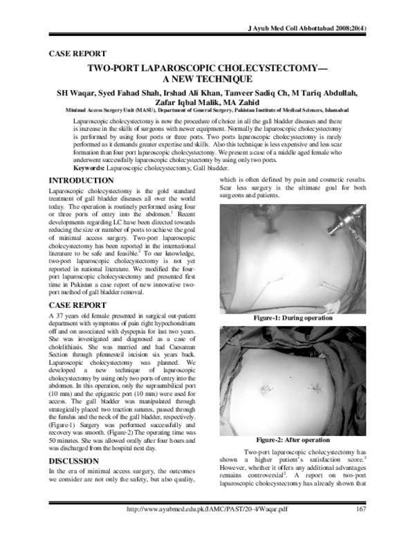 (PDF) Two-port laparoscopic cholecystectomy--a new technique
