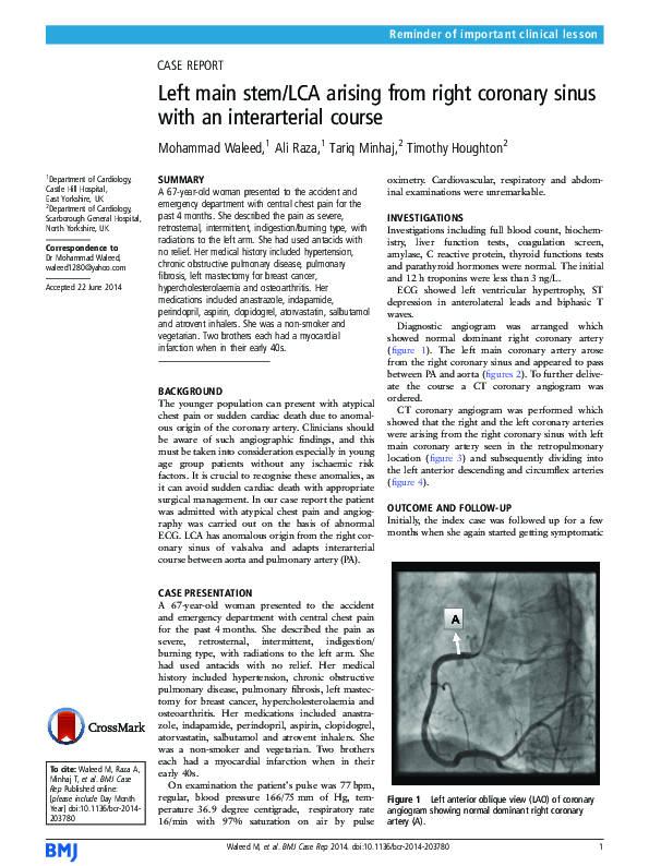 (PDF) Left main stem/LCA arising from right coronary sinus with an ...