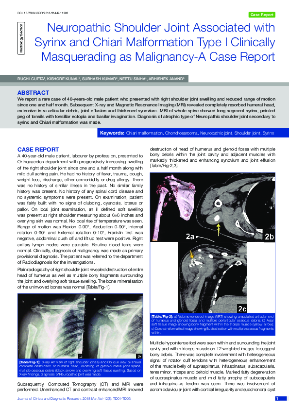 (PDF) Neuropathic Shoulder Joint Associated with Syrinx and Chiari ...
