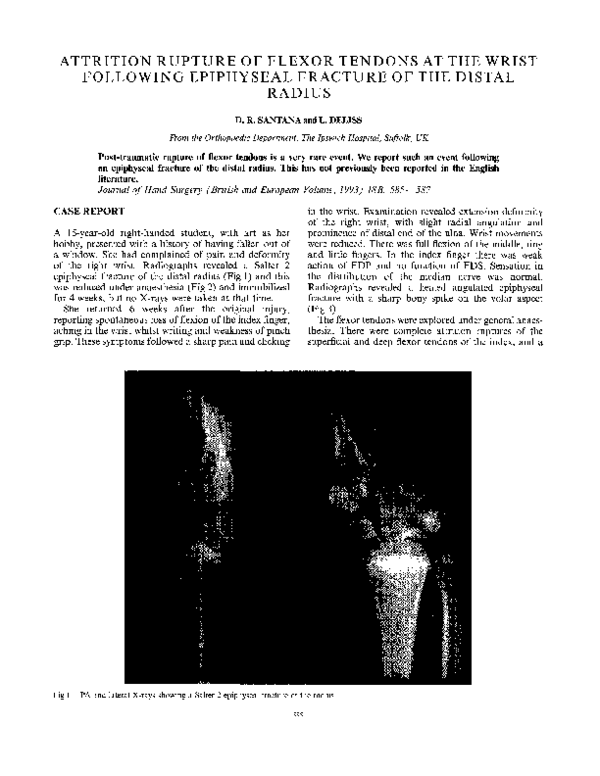 (PDF) Attrition rupture of flexor tendons at the wrist following ...