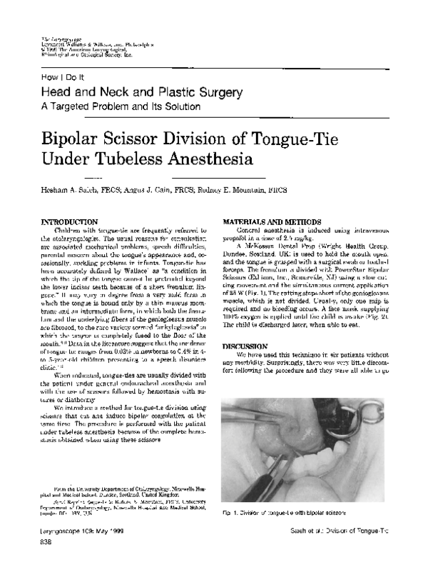 (PDF) Bipolar scissor division of tongue-tie under tubeless anesthesia