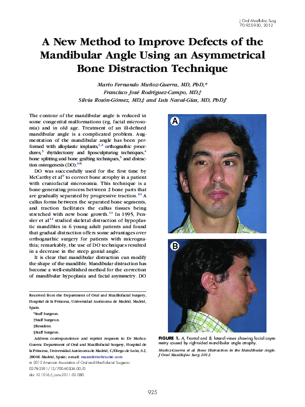 (PDF) A New Method to Improve Defects of the Mandibular Angle Using an ...