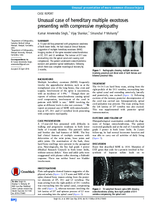 (PDF) Unusual case of hereditary multiple exostoses presenting with ...