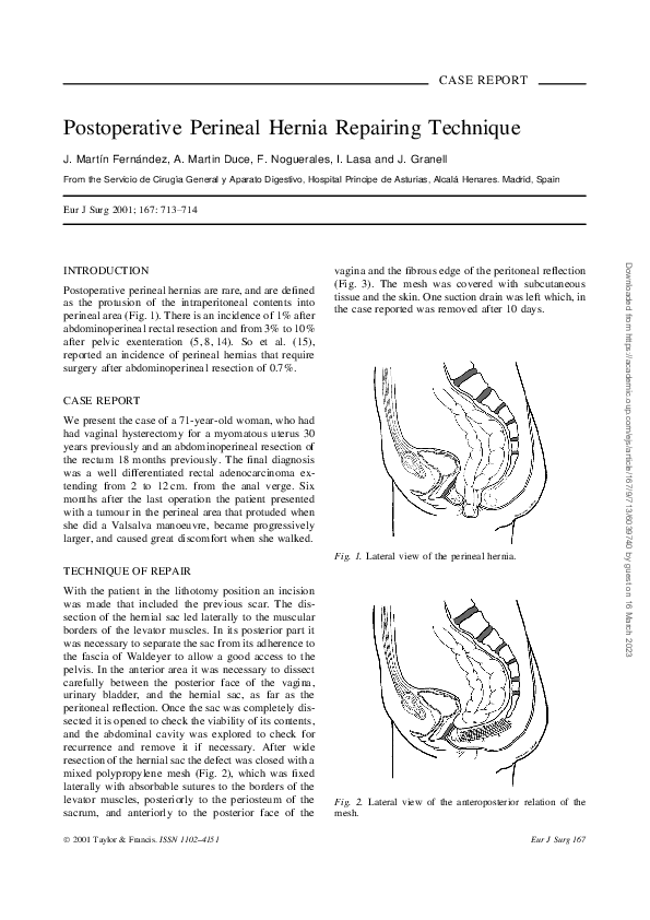 Postoperative Perineal Hernia Repairing Technique