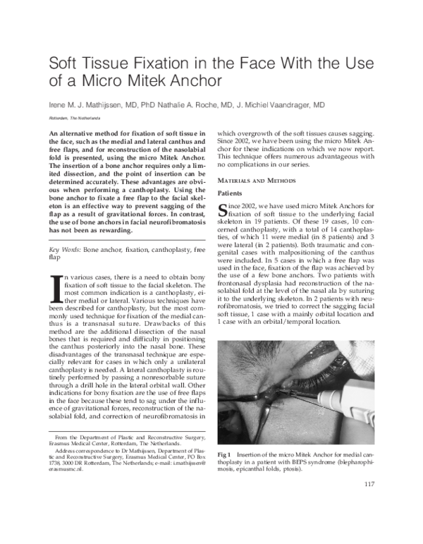 (PDF) Soft Tissue Fixation in the Face With the Use of a Micro Mitek Anchor