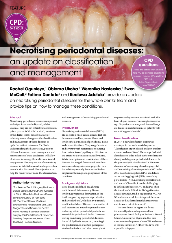 (PDF) Necrotising periodontal diseases: an update on classification and management | Fatima ...