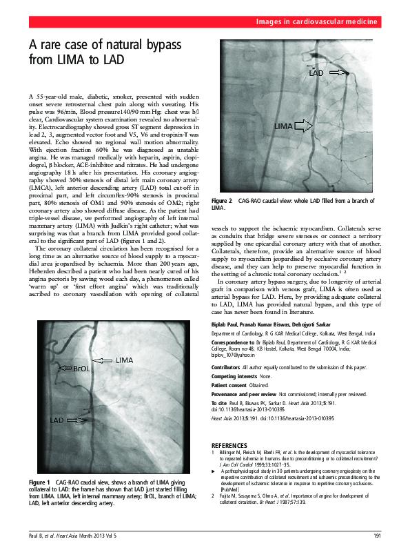 (PDF) LIMA's Natural Bypass to LAD: A Unique Case