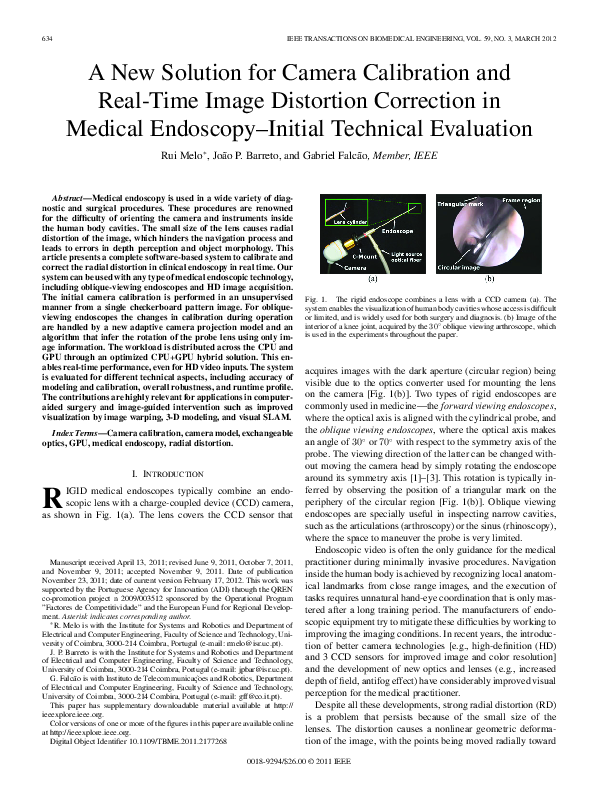 Pdf A New Solution For Camera Calibration And Real Time Image Distortion Correction In Medical