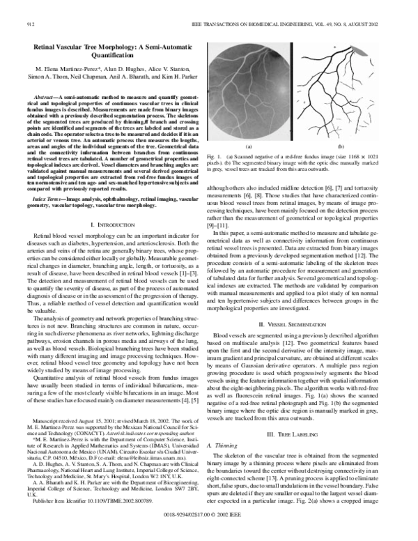 (PDF) Retinal vascular tree morphology: a semi-automatic quantification